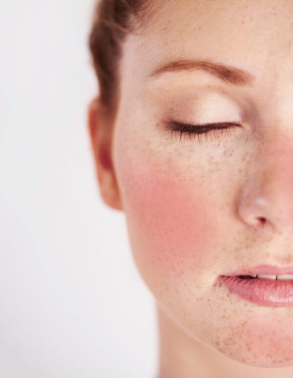 Flushing facial: por qué te pones roja y cómo calmarlo